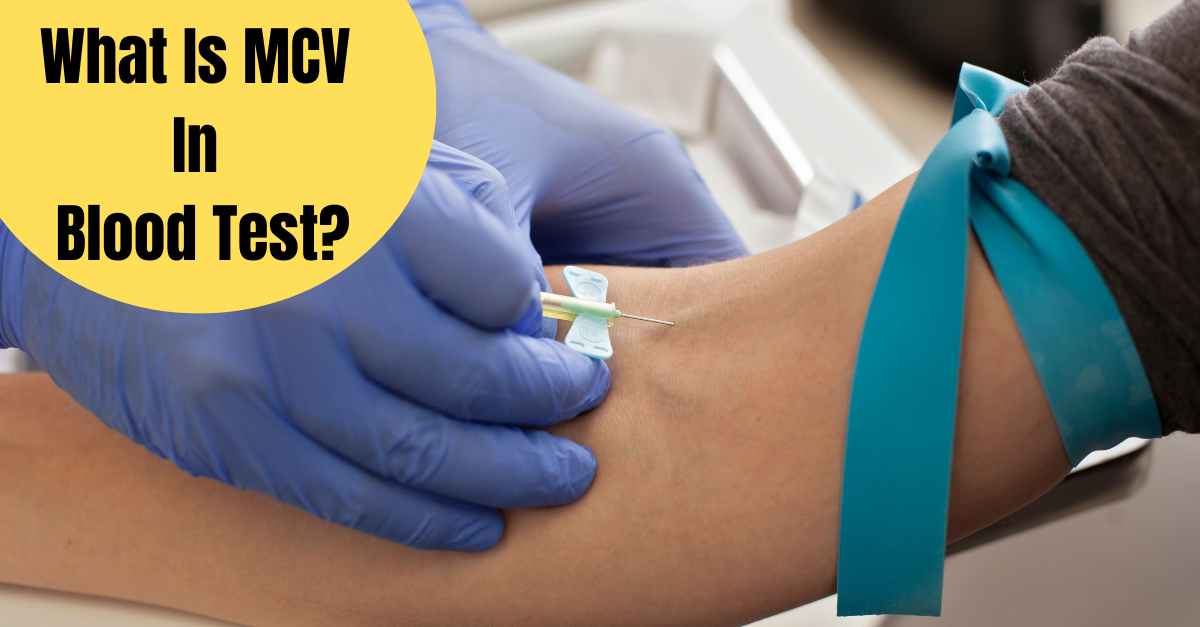 Marvel Path Lab - Best Pathology Lab In India